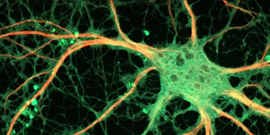 Computational Graphs - Deep Learning From Scratch - Theory and ...